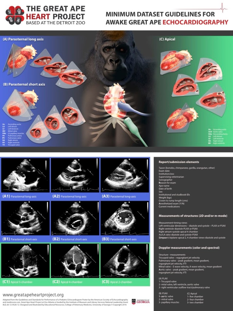Performing Echocardiograms